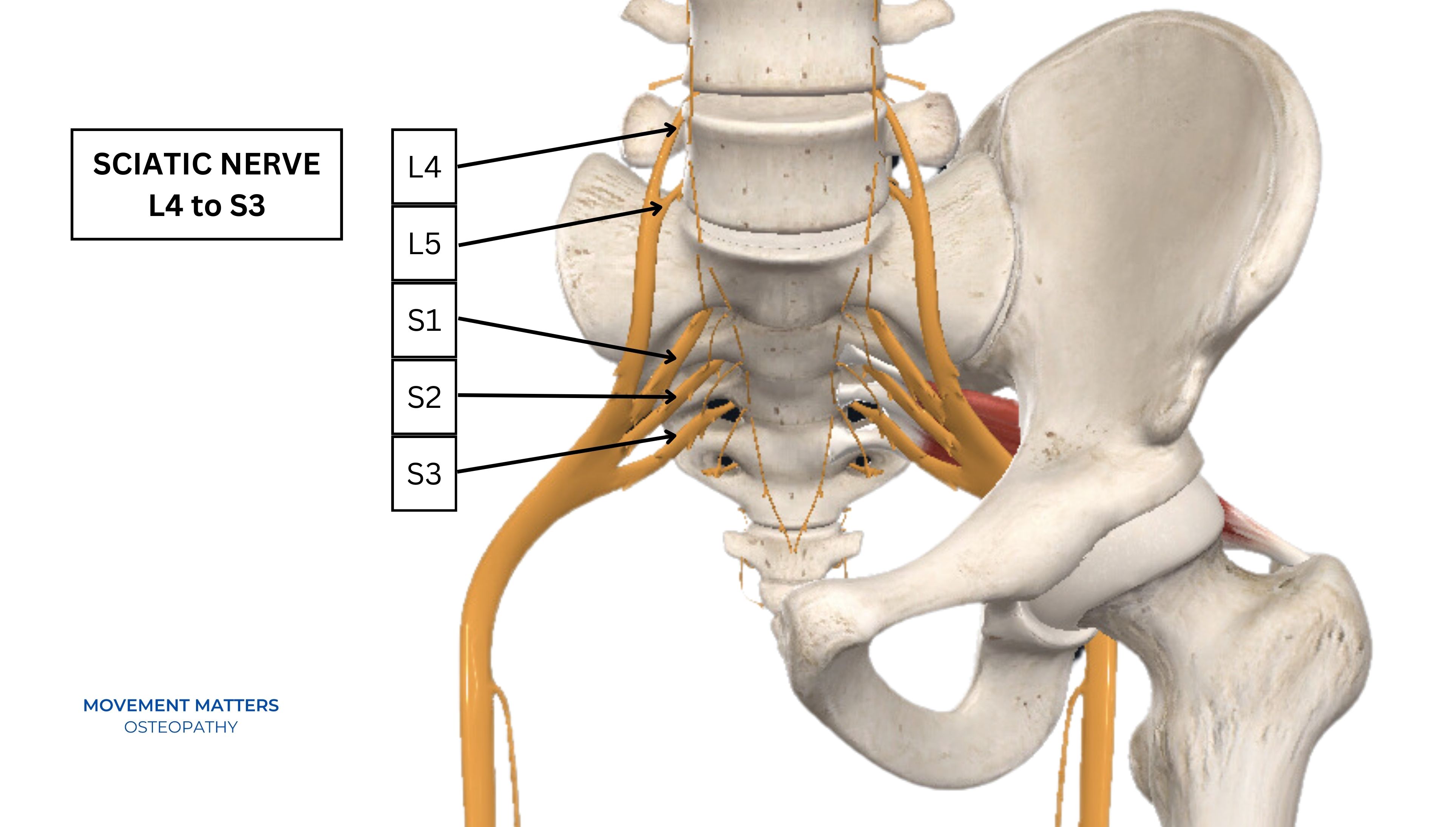 Sciatica Symptoms, Causes, and Treatment: Essential Guide
